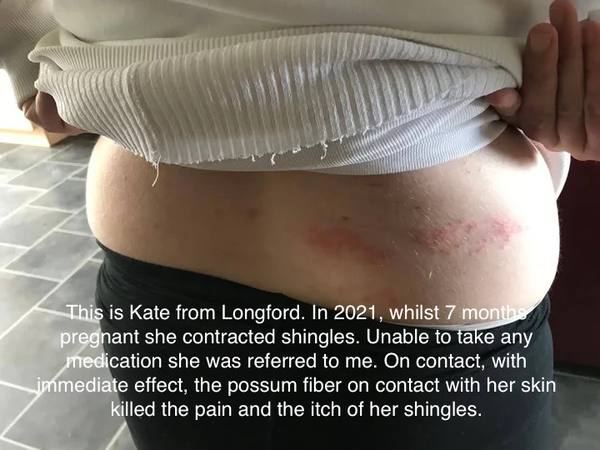 Possum Back Straps for shingles, pain management | Kiwi Country Clothing